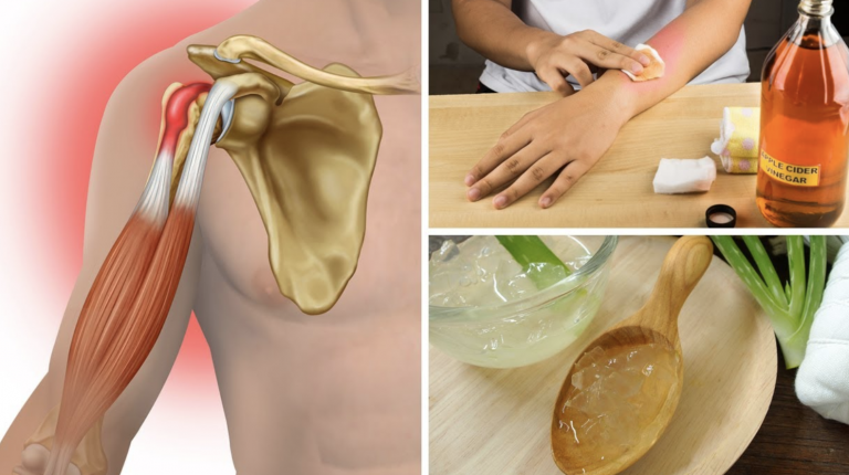 6 home remedies that can help you deal with a sore back | Grandma's Things