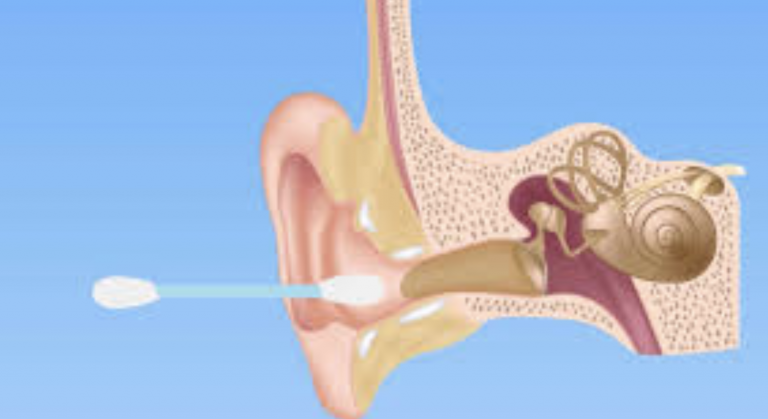 8 Efficient Ways to Clean Your Ears Without Cotton Buds | Grandma's Things