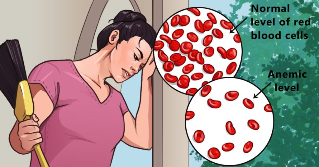Headaches and fatigue are common symptoms of anemia. Here are 6 ways to ...