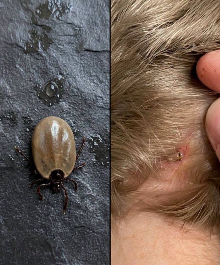 How to stay calm when you find unwanted “guests” in your child’s hair ...